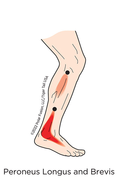 Trigger Point Therapy for Myofascial Pain Syndrome